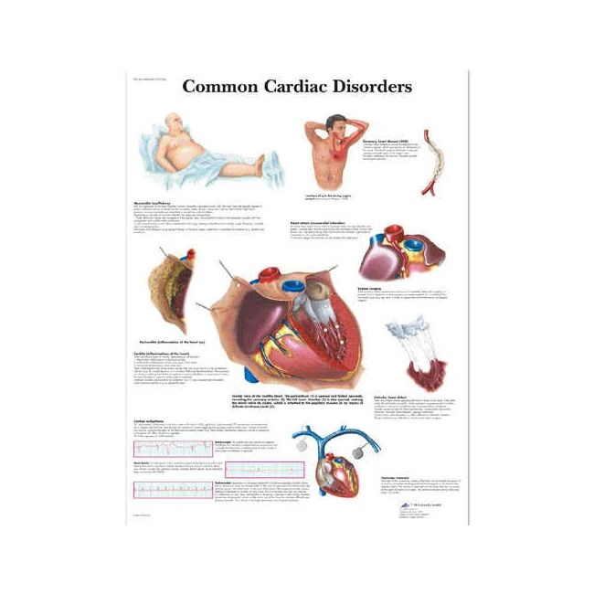 Fabrication Enterprises Inc Z12965 Common Cardiac Disorders Anatomical ...