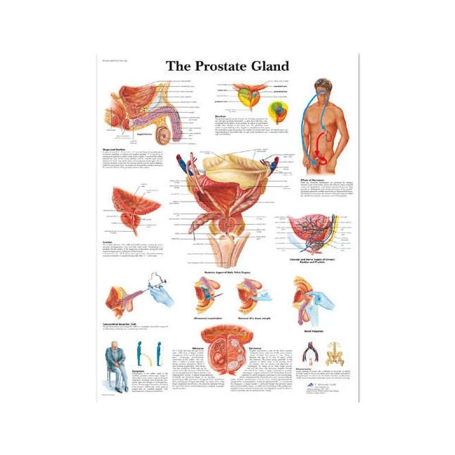 Fabrication Enterprises Inc Z13430 Prostate Gland Anatomical Chart ...